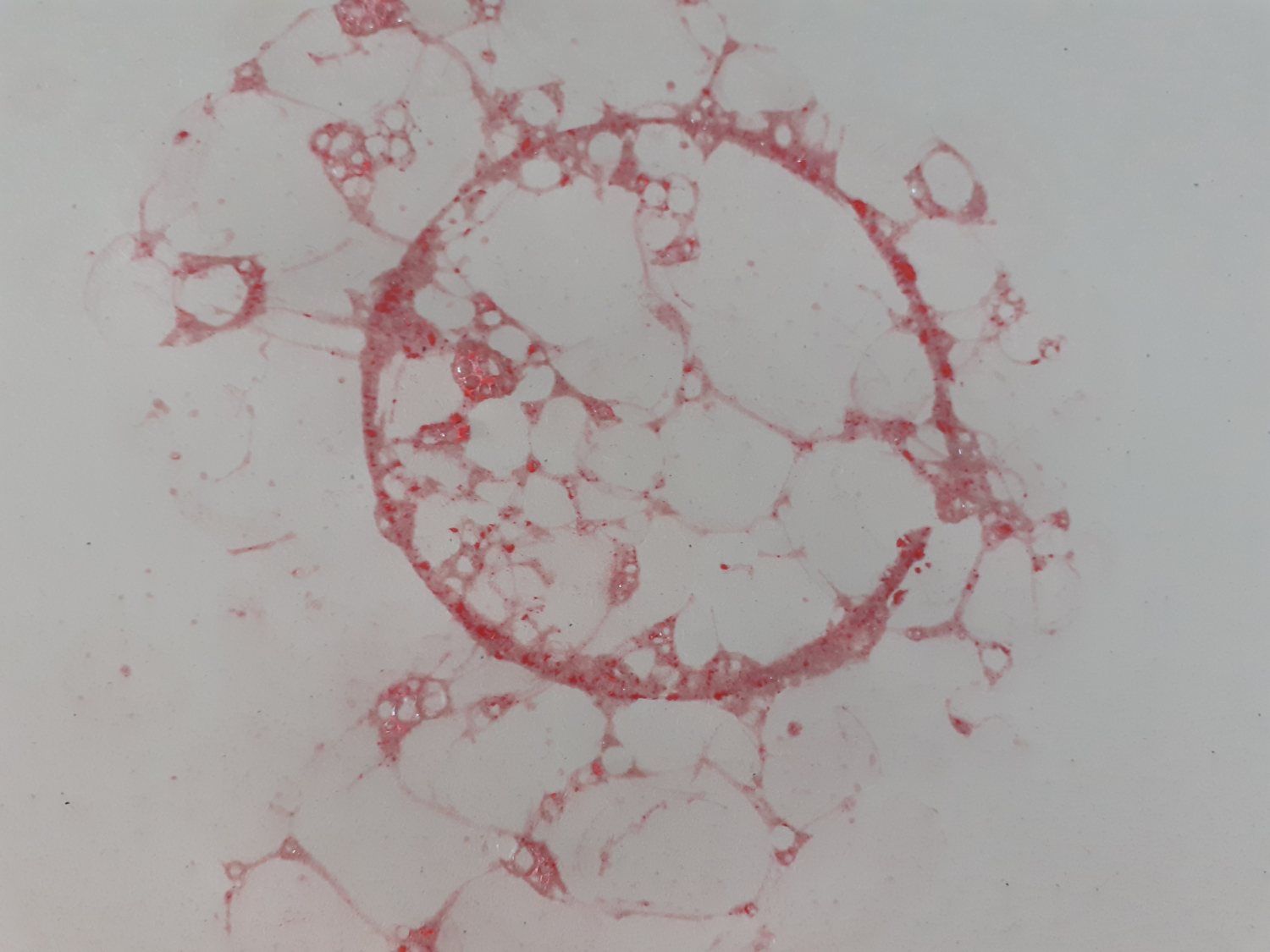 Blowing bubbles provocation - NUSTEM